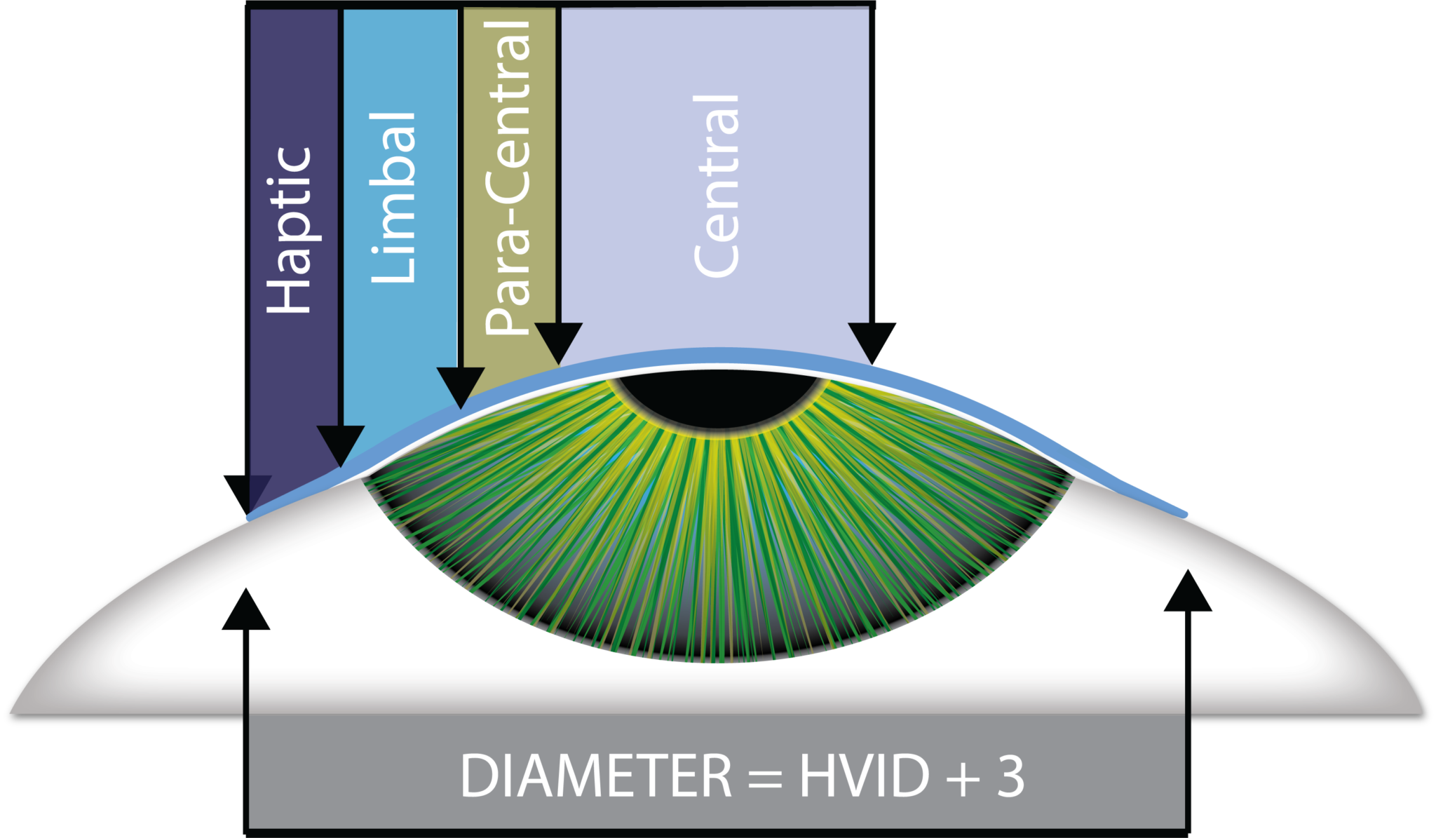 Naturalens MINI Side Diagram Vector For Fitting Guide – Advanced Vision ...